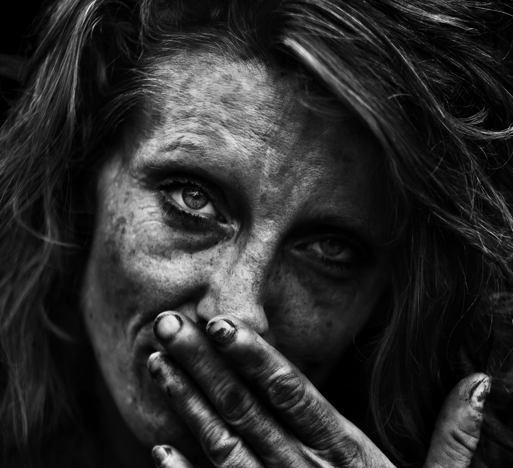 Unhoused: Exploring Experiences and Promoting Empathy Through Art and ...
