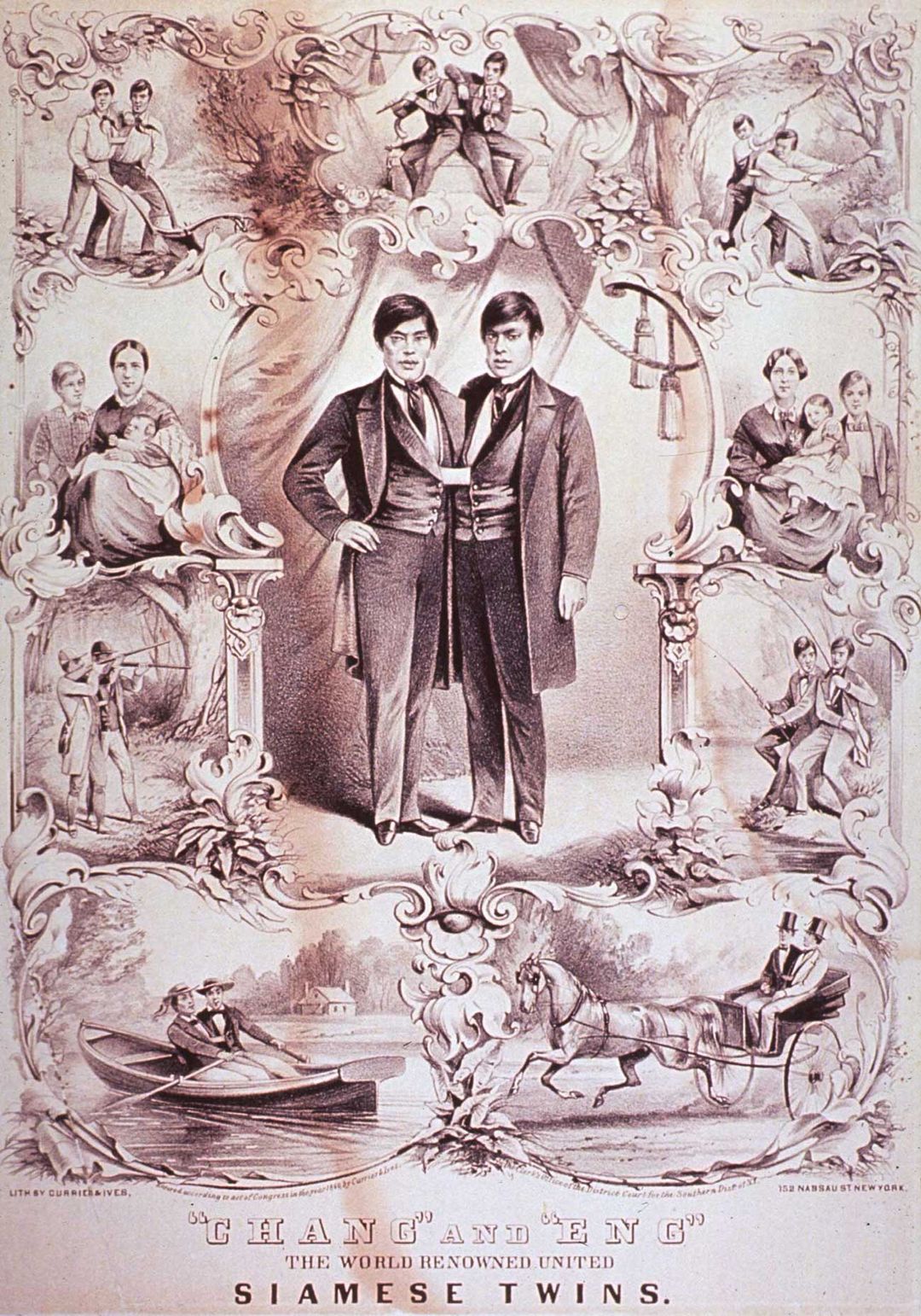 Bonded by Livers and Love: The Chang and Eng Story | Mütter Museum